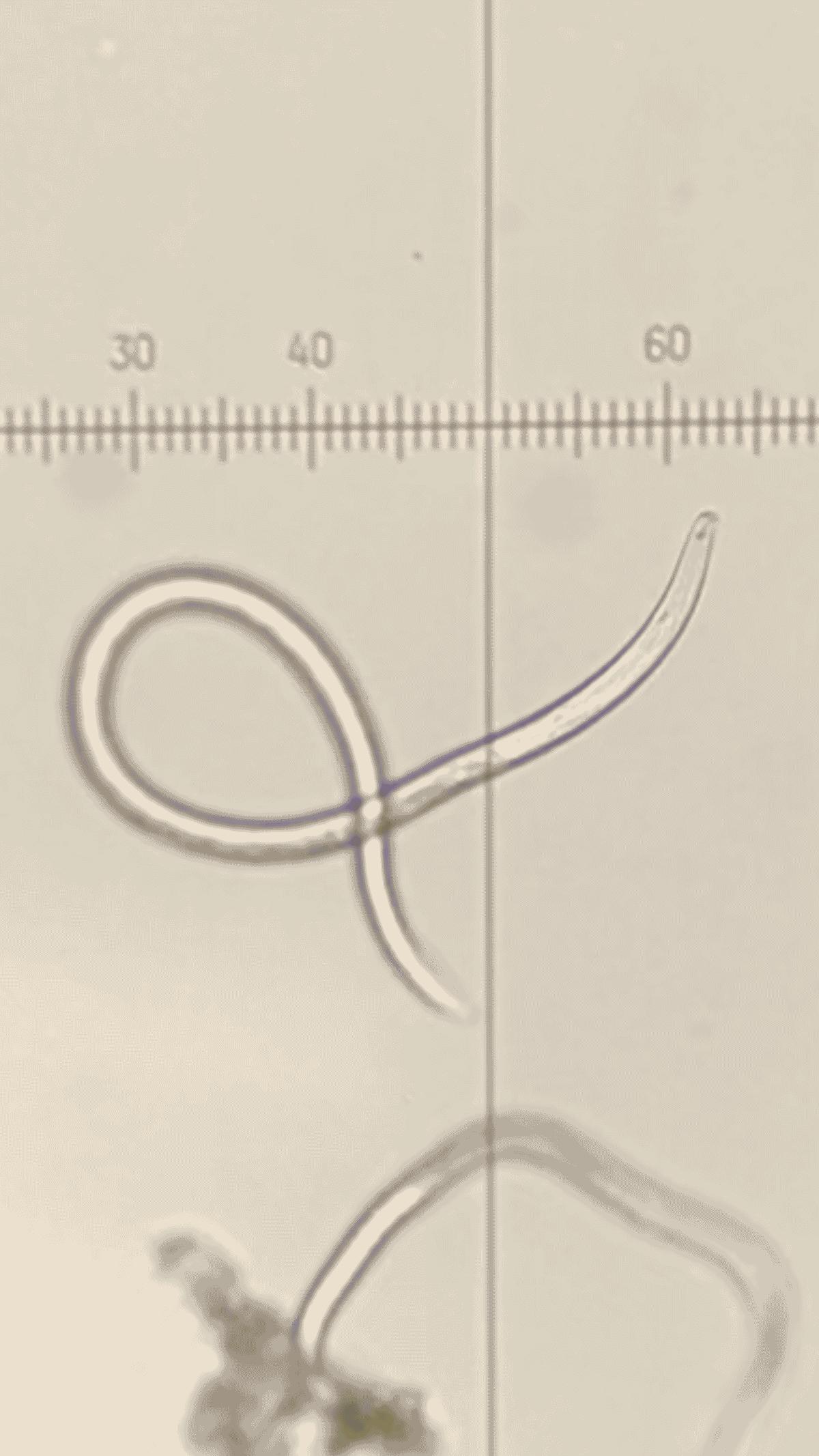 Forest pathogens and tree health » HF&G