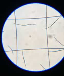 Researchers develop new detection tool for beech leaf disease’s ...